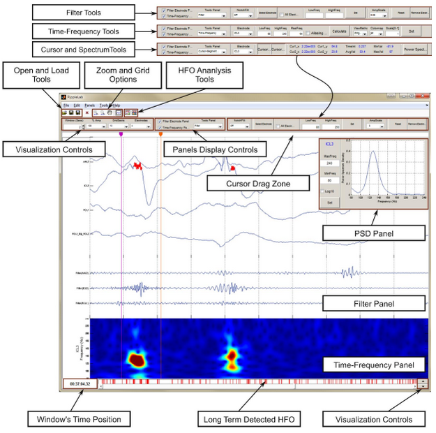 RIPPLELAB: A visual tool for HFO analysis - Miguel Navarrete, PhD