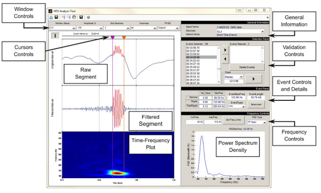 Ripplelab A Visual Tool For Hfo Analysis Miguel Navarrete Phd