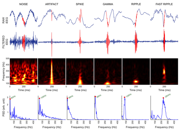 Methodological advances for HFO analysis - Miguel Navarrete, PhD